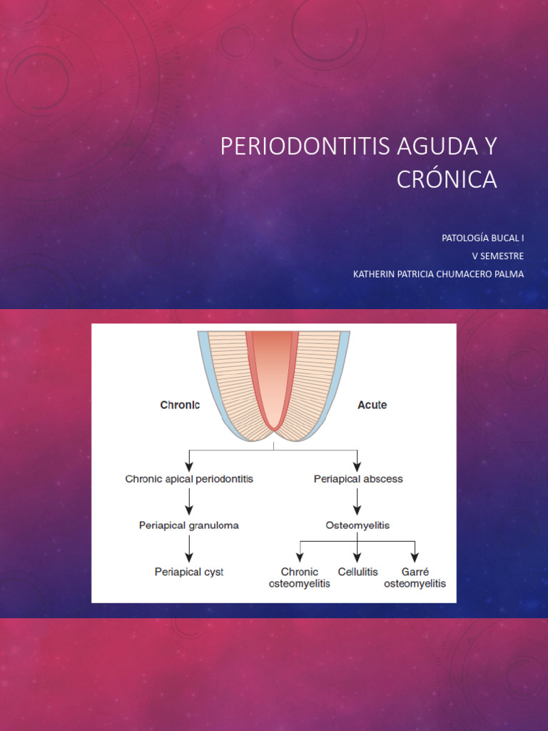 Periodontitis Aguda y Crónica | PDF | Hueso | Epitelio