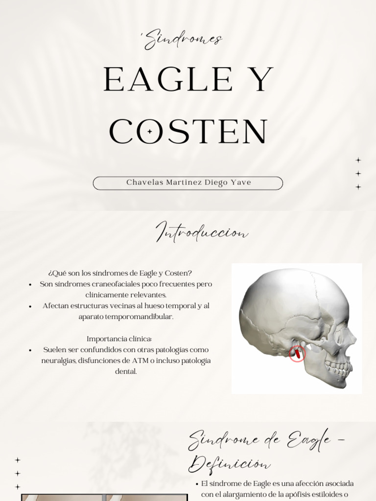 Sindrome de Eagle y Costen | PDF