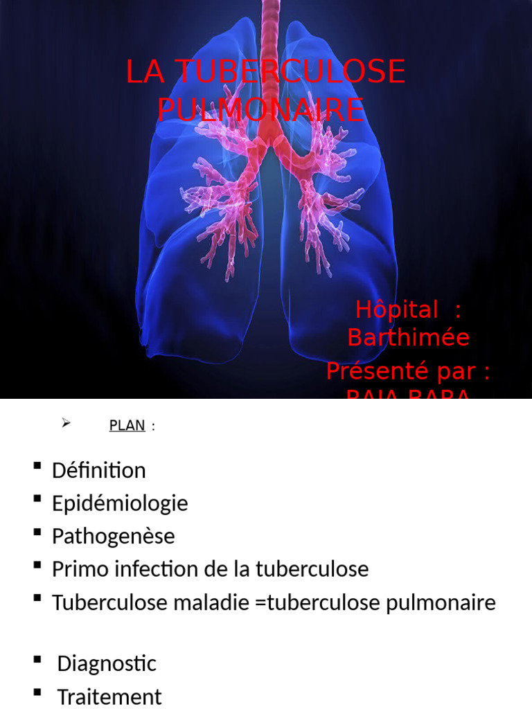 Tuberculose pulmonaire : diagnostic et traitement | PDF | Tuberculose ...