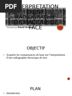 Syndrome bronchique et épaississement pariétal | PDF