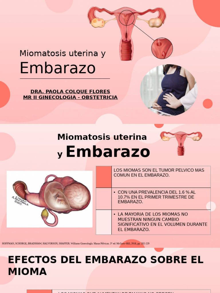 Nuevo Mioma | PDF | Parto | El embarazo