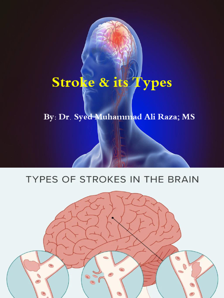 Strokes & Its Types | PDF