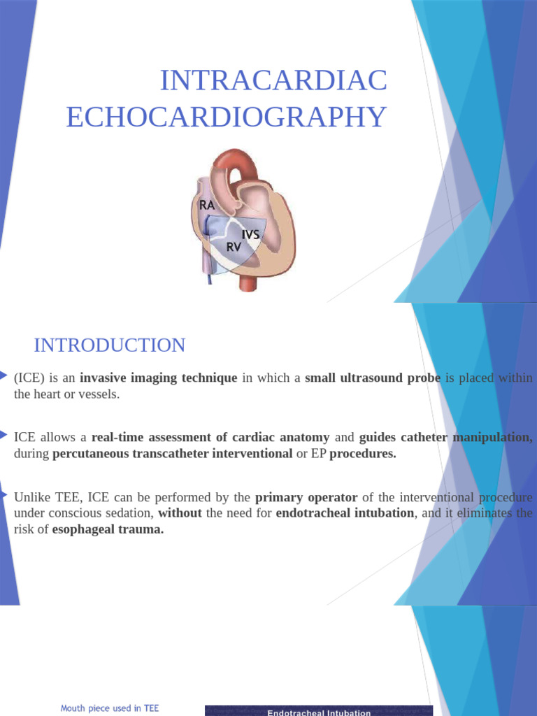 Intracardiac Echocardiography Overview | PDF | Atrium (Heart ...