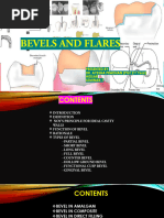 Bevels in Dentistry | PDF | Tooth Enamel | Dental Composite
