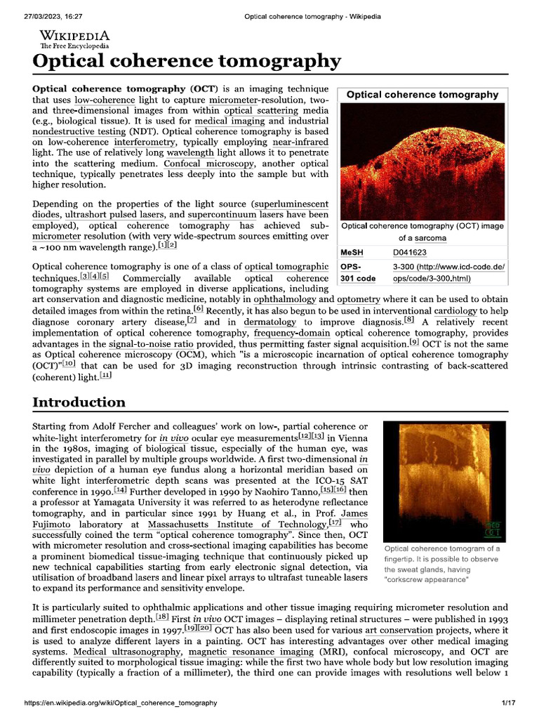 Optical Coherence Tomography Wikipedia | PDF