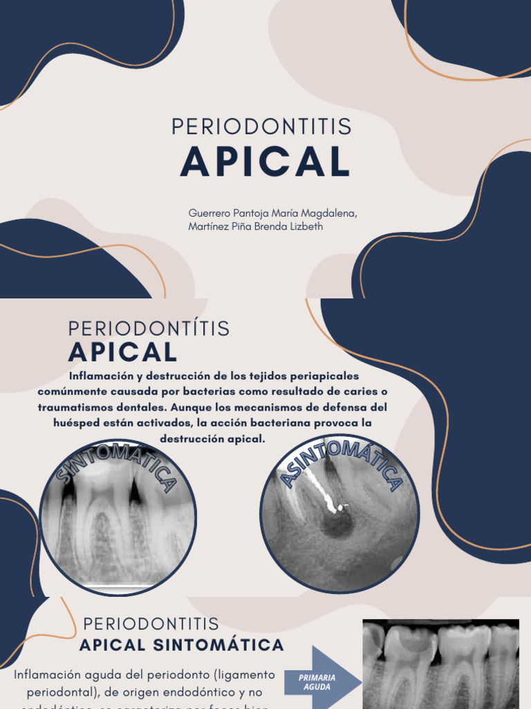 9 - Periodontitis Apical Asintomática y Sintomática | PDF | Inflamación ...