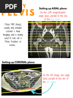 Mako Knee CT Scanning Protocol | PDF | Pelvis | Knee