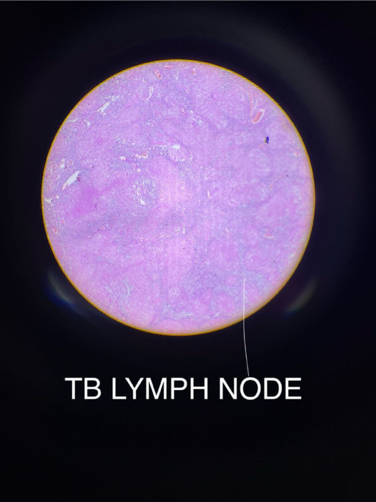 Histopath Finalll | PDF