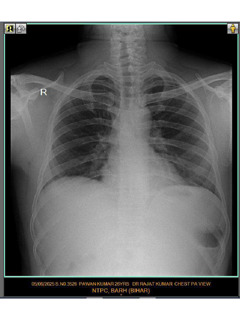 3526 Pawan Kumar | PDF