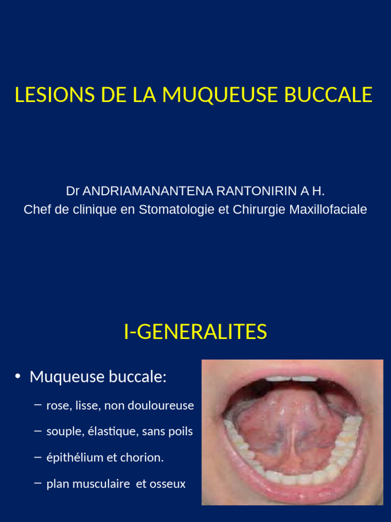 Lesions de La Muqueuse Buccale | PDF | Épithélium | Anatomie humaine