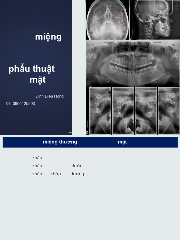 Phim Ngoai Mieng LS | PDF
