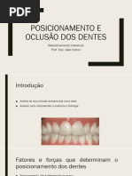 Classificação de Angle: Classes I, II e III | PDF