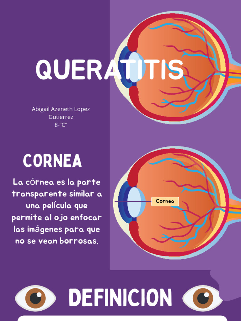 Guía Completa sobre Queratitis Ocular | PDF | Medicina CLINICA ...