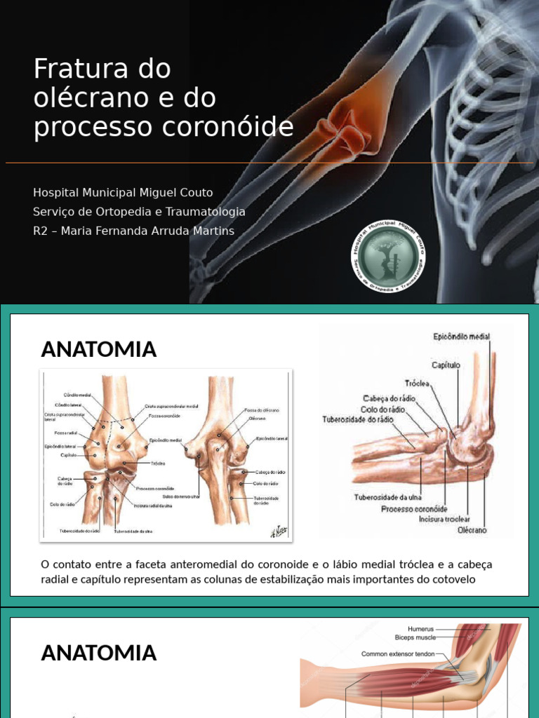Fratura Do Olecrano e Processo Coronoide | PDF | Cotovelo | Medicina ...
