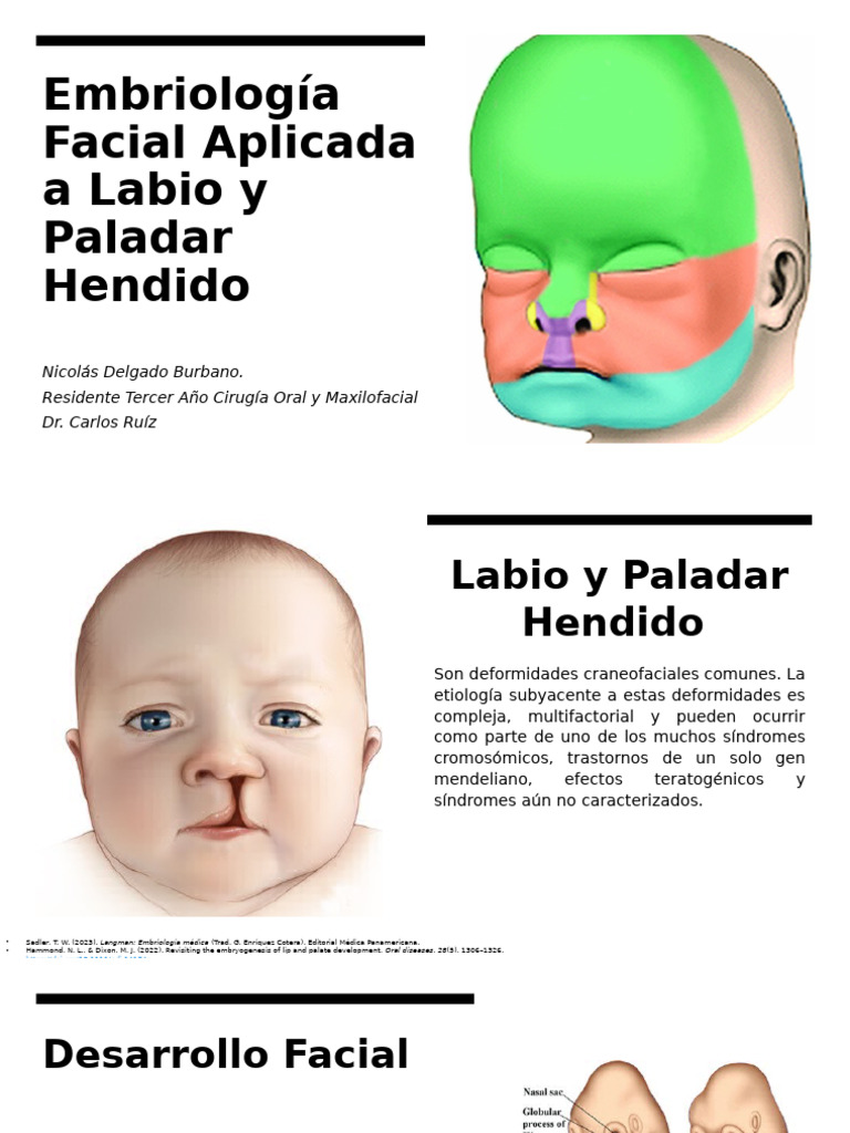 Embriología del Labio y Paladar Hendido | PDF | Anatomía | Biología del ...