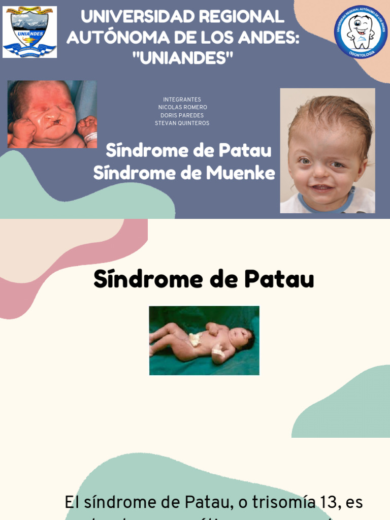 Síndrome de Patau y Muenke | PDF | Odontología | Enfermedades y trastornos