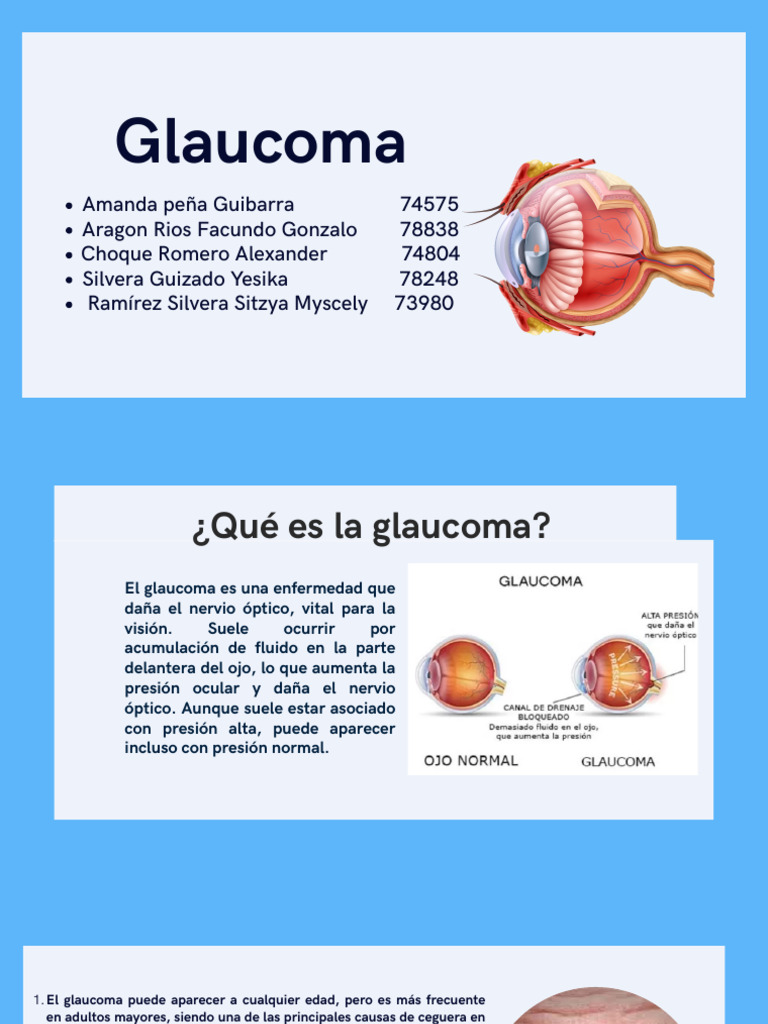 Glaucoma: Tipos, Síntomas y Tratamiento | PDF | Glaucoma | Ojo humano