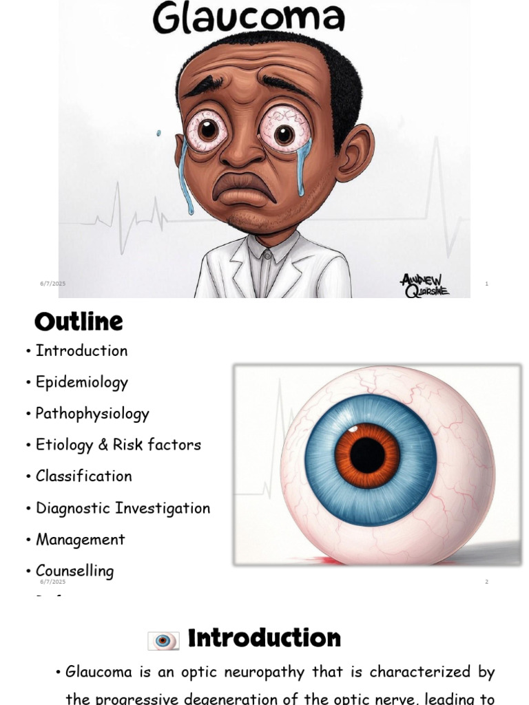 Glaucoma Andrew Quarshie | PDF | Glaucoma | Ophthalmology