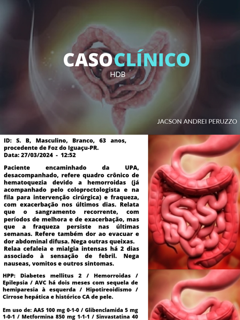 Hematoquezia e Esfincter Normotônico | PDF | Hemorroida | Colonoscopia