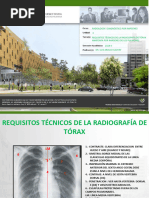 Radiografía de Tórax Normal - Patrón Intersticial | PDF | Pulmón | Tórax