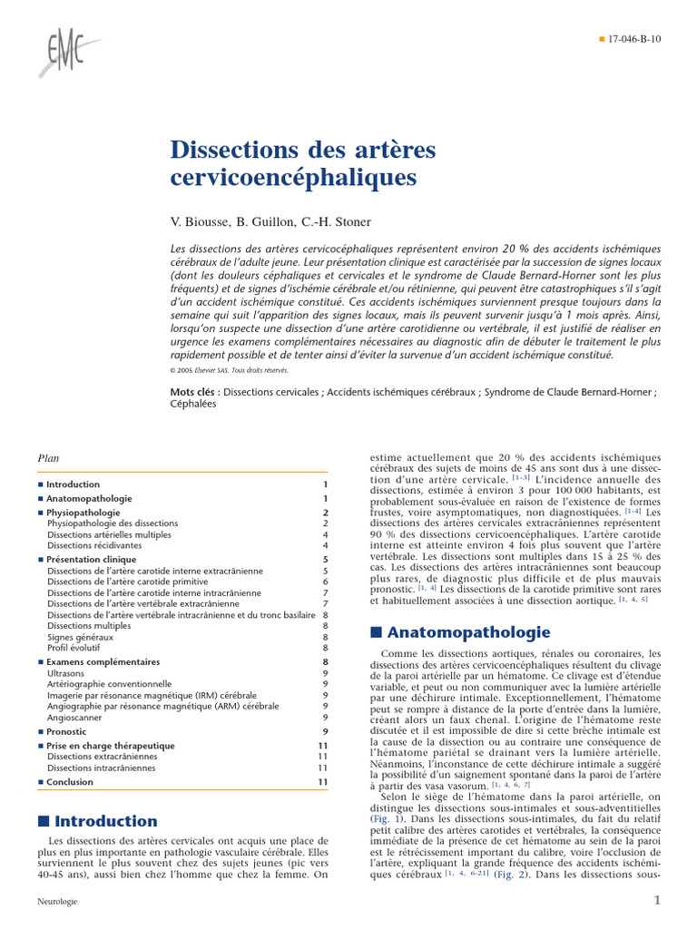 Dissections des artères cervicoencéphaliques | PDF | Angiologie ...