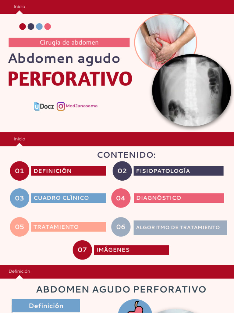 Abdomen Agudo Perforativo: Diagnóstico y Tratamiento | PDF | Abdomen ...