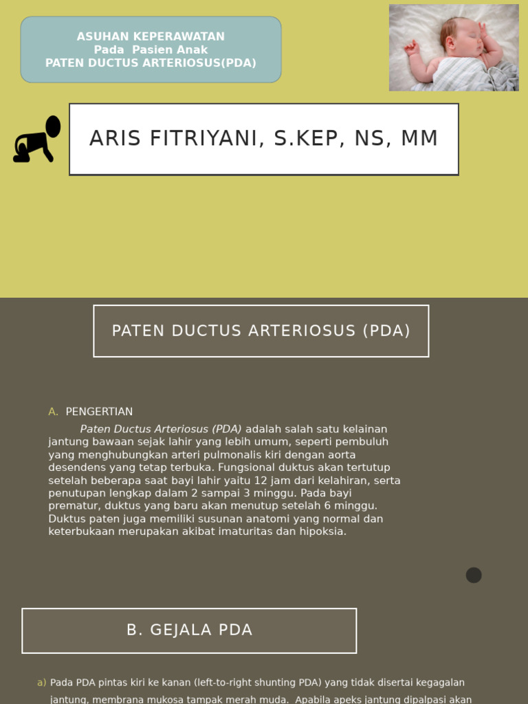 Paten Ductus Arteriosus (PDA) | PDF