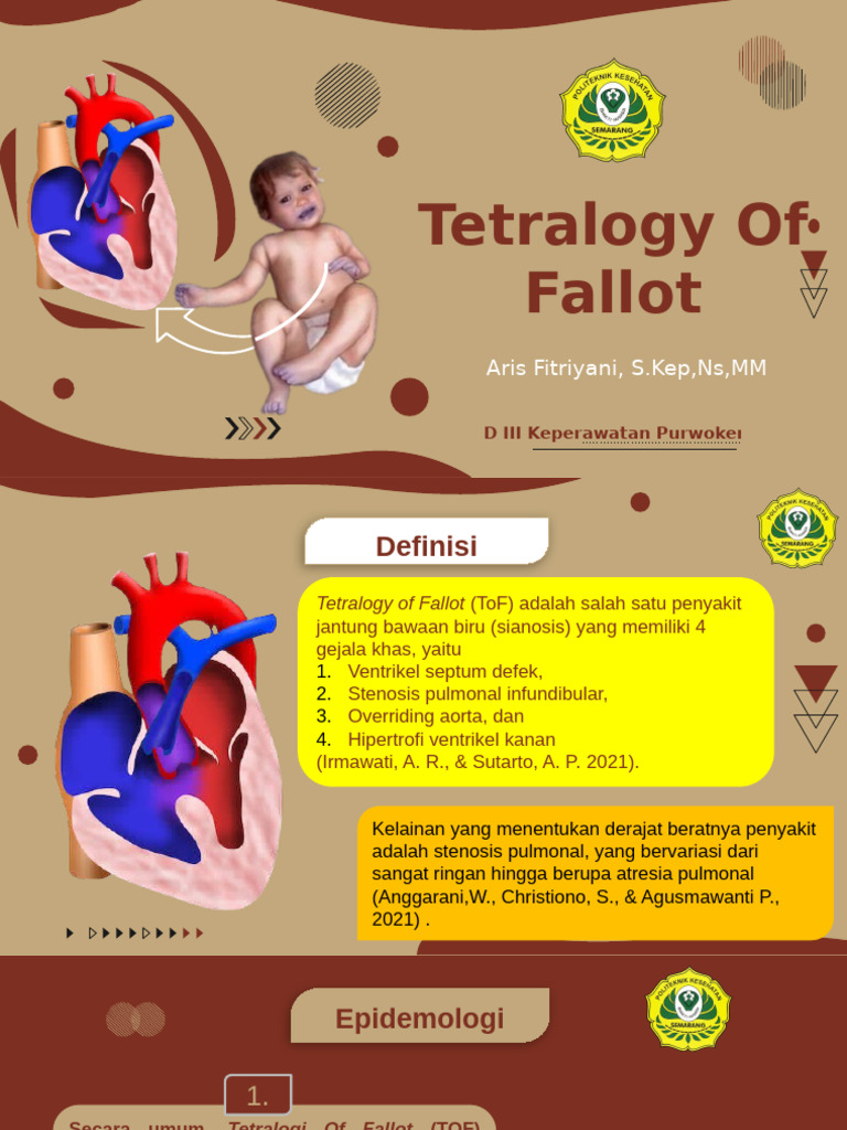 Tetralogy of Fallot | PDF