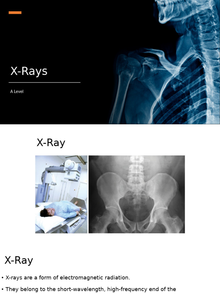 X-Ray and Ultrasound | PDF | Gamma Ray | X Ray