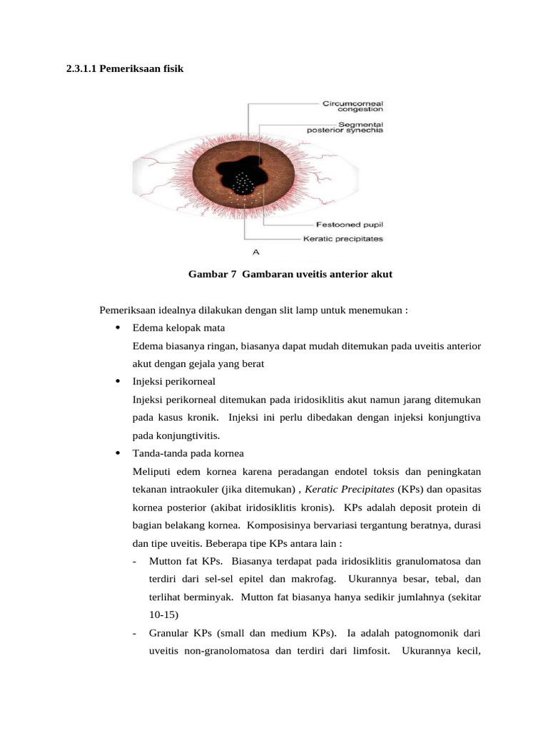 Pemeriksaan Fisik UVEITIS | PDF