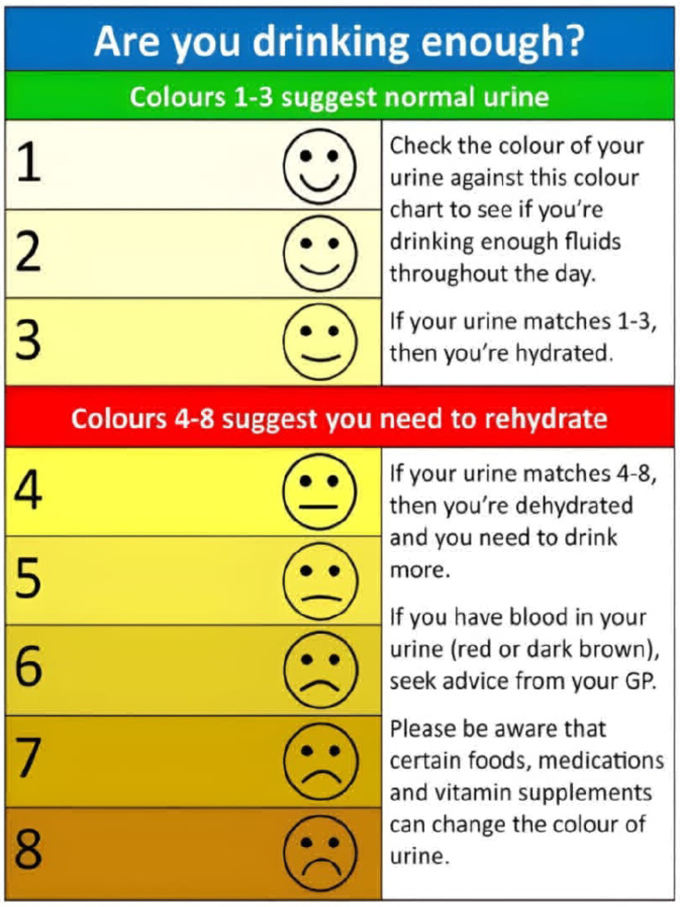 Urine Color Poster For Washroom | PDF
