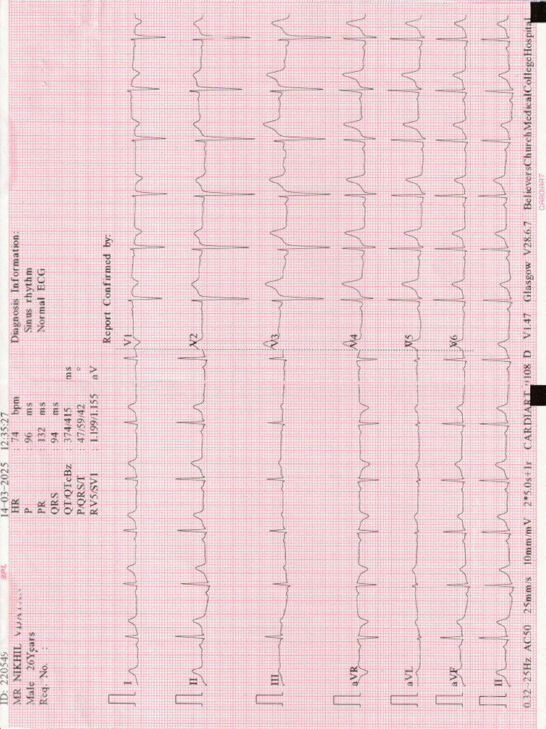 Ecg | PDF