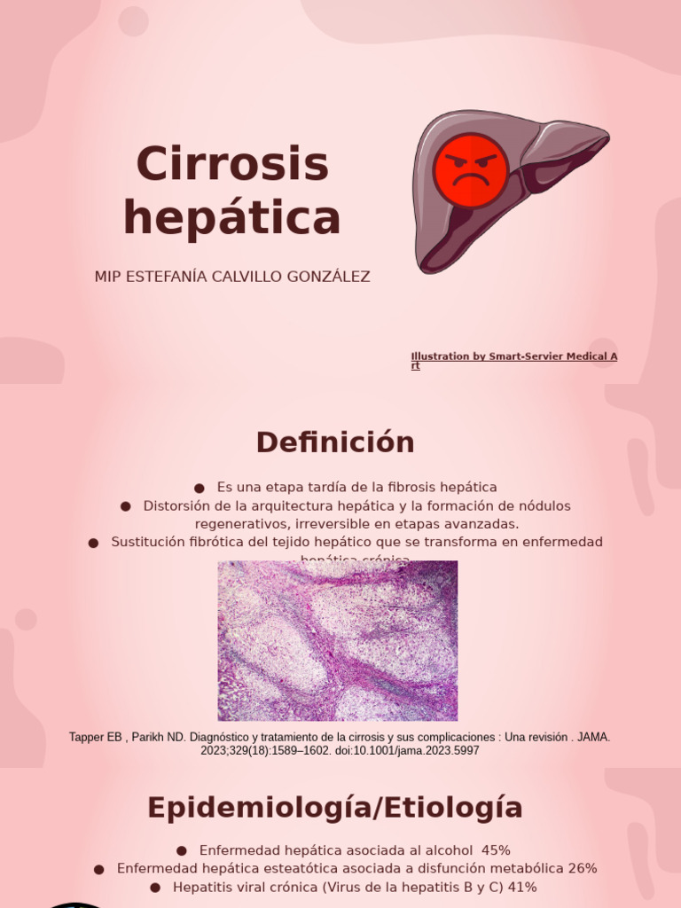 Cirrosis Hepática ECG | PDF | Cirrosis | Especialidades Medicas