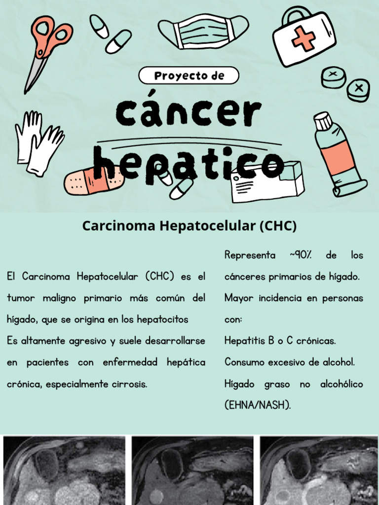 Cáncer Hepatico - Exposicion | PDF | Cirrosis | Cáncer