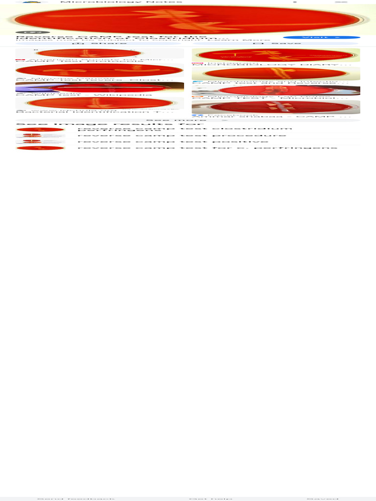 Reverse Camp Test Diagram - Google Search | PDF