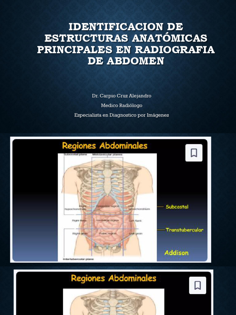 Anatomia RX Abdomen 2024 | PDF