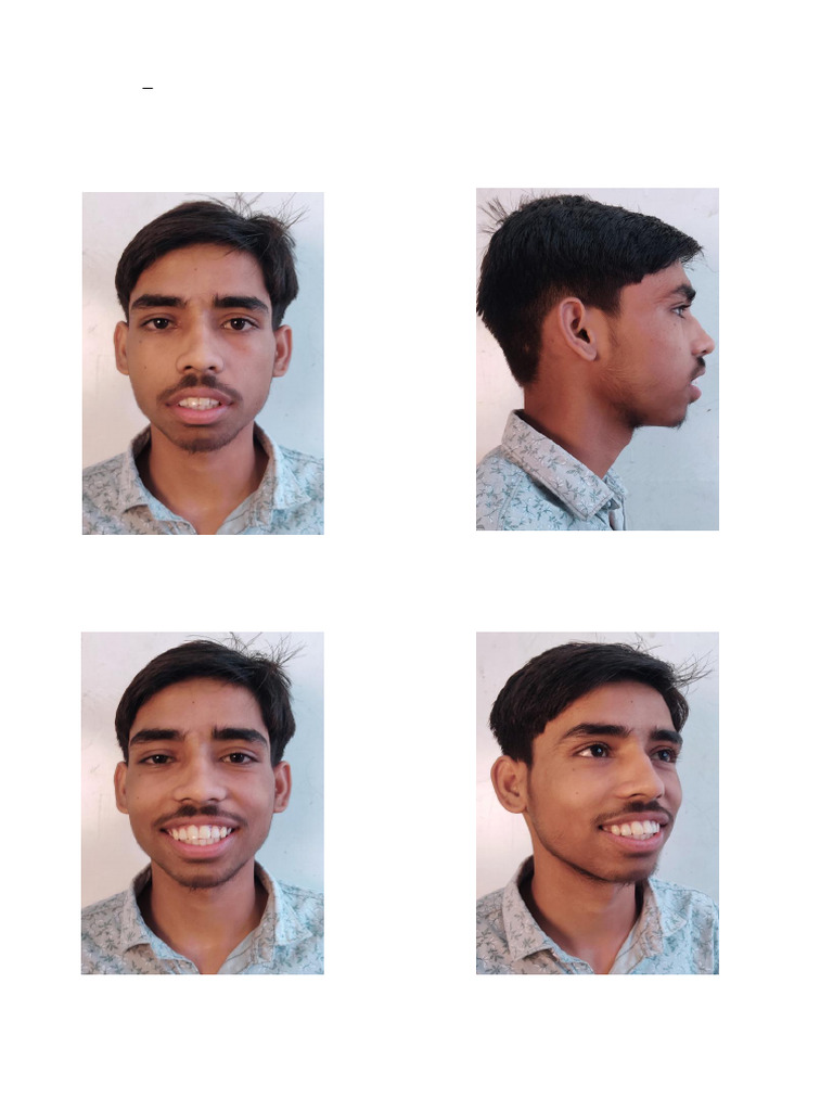 Pre Photos Anuj Yadav | PDF