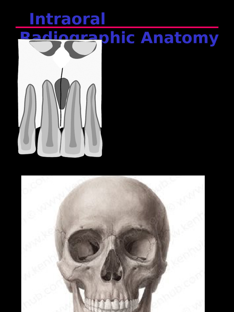 Intraoral Radiographic Anatomy Overview | PDF | Dental Anatomy | Human Nose