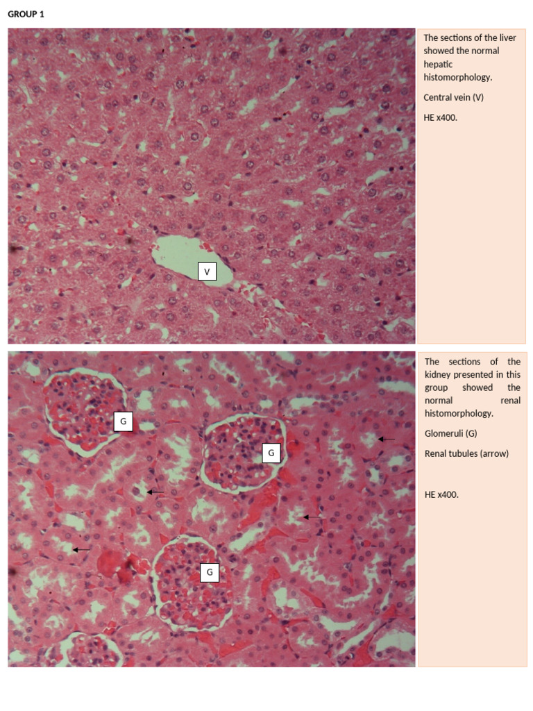 Histopathological Findings - Liv Kid Prost | PDF | Epithelium | Kidney