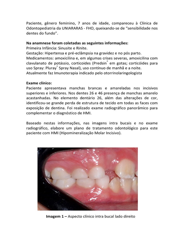 Tratamento de HMI em Odontopediatria | PDF