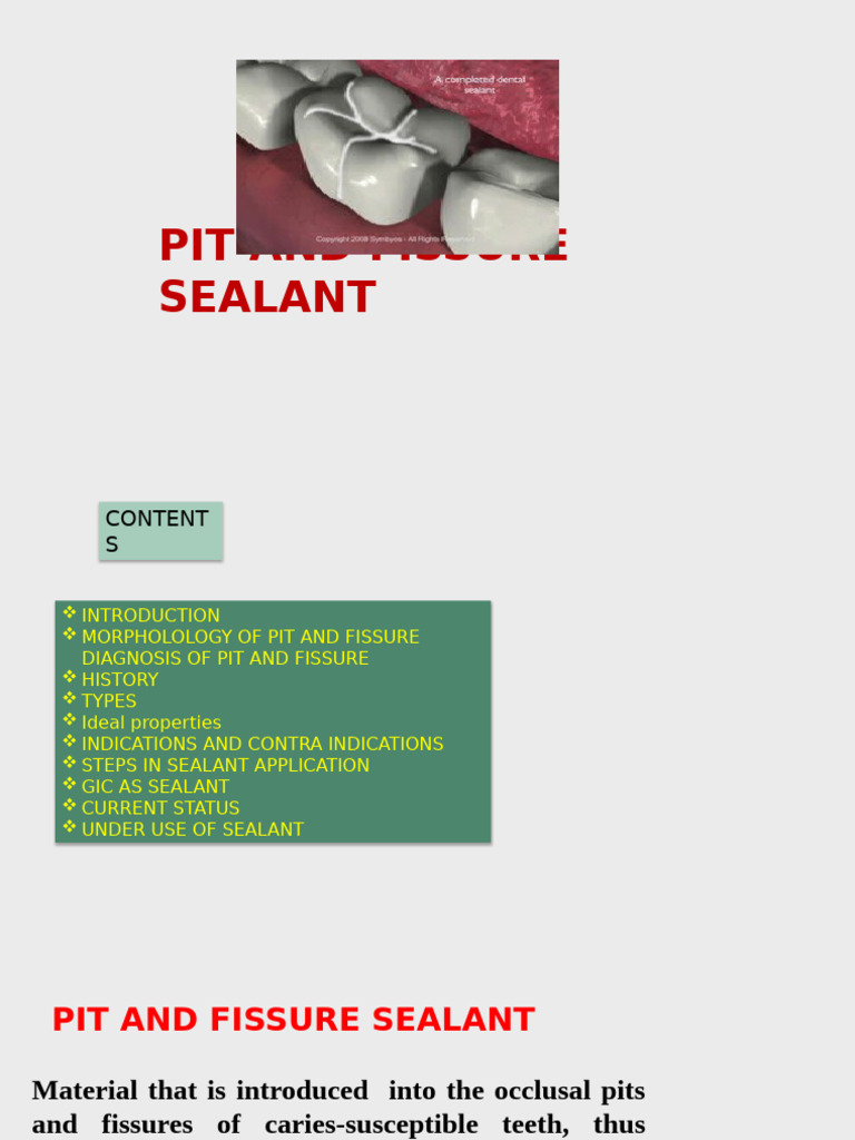 Pit and Fissure Sealants PRR | PDF | Tooth Enamel | Dentistry