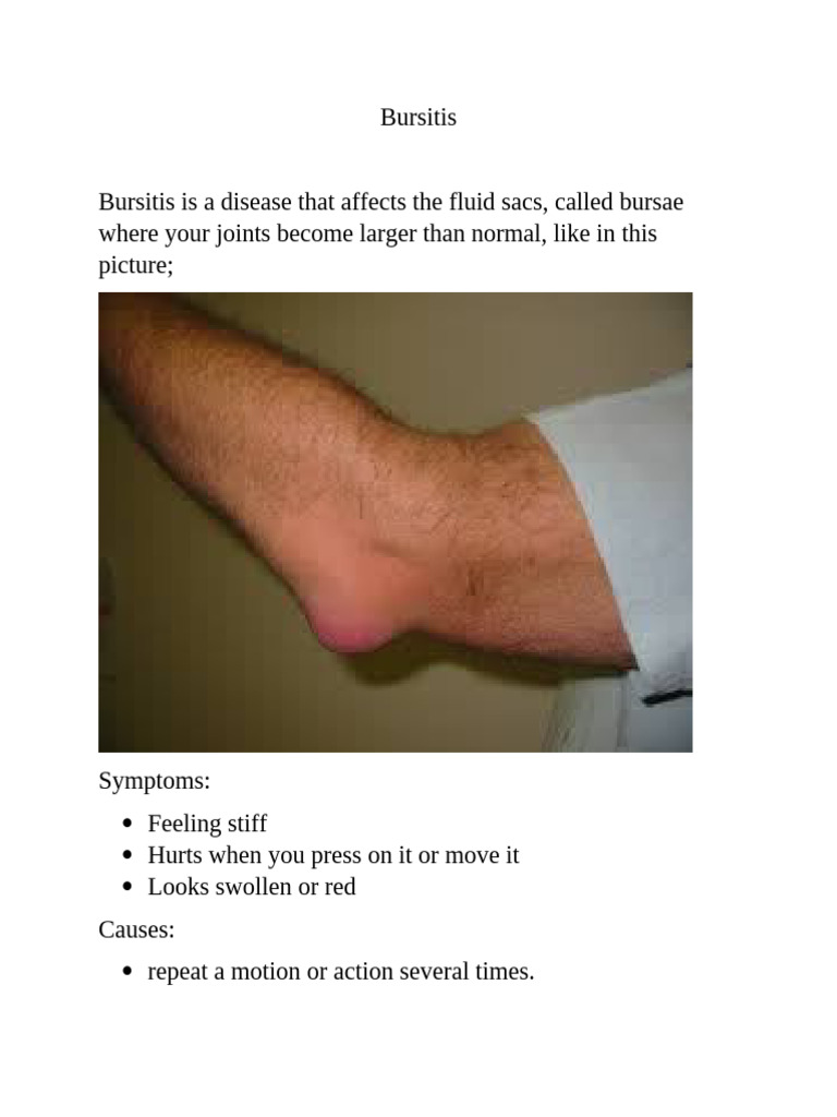 Understanding Bursitis Symptoms and Causes | PDF