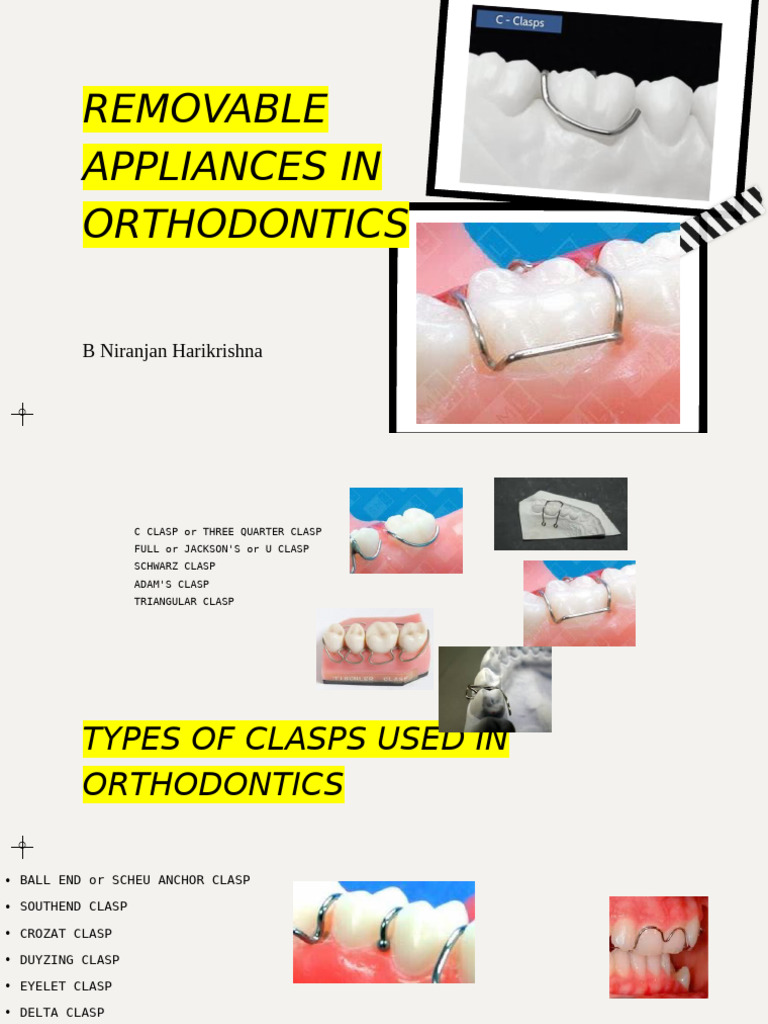 REMOVABLE APPLIANCES of Orthodontics | PDF | Orthodontics | Tooth