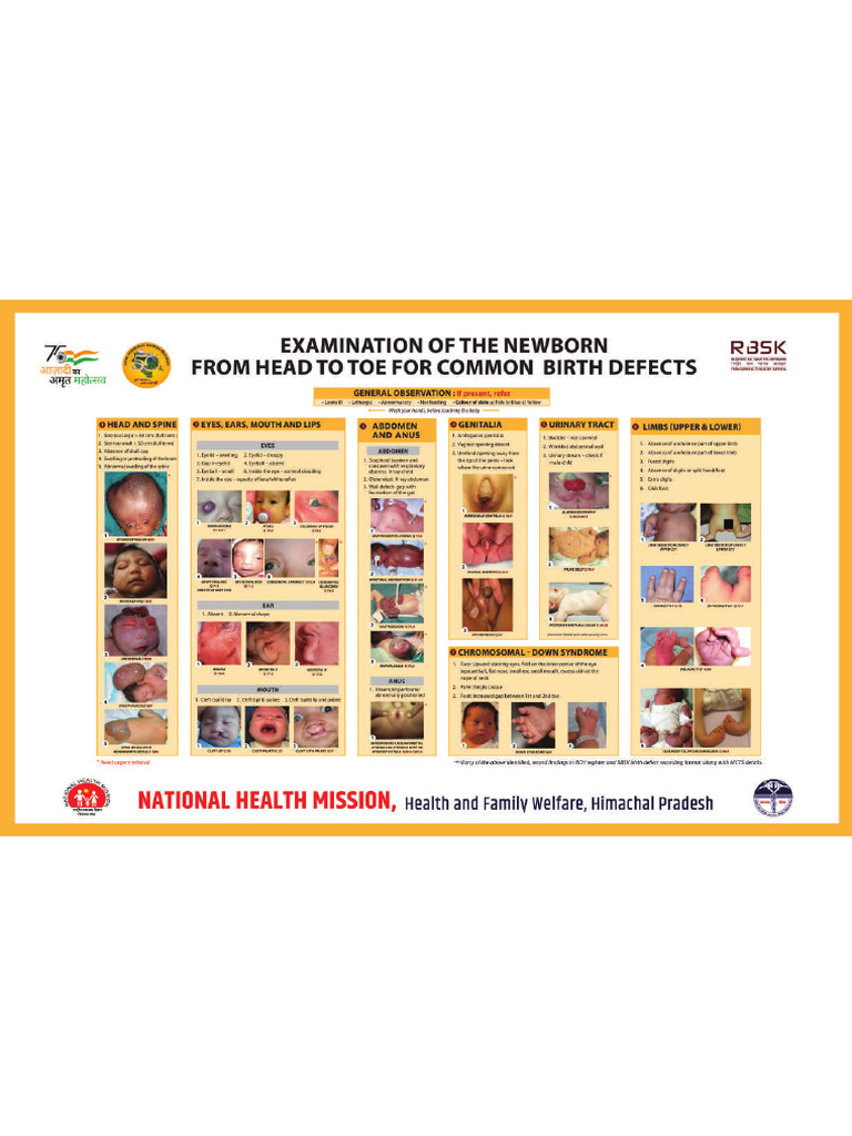 Birth Defect Sunboard | PDF