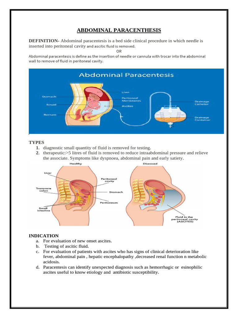Assignment - Abdominal Parasenthesis | PDF | Medical Specialties | Clinical Medicine