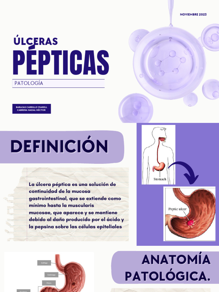 Úlceras Pépticas: Causas y Tratamiento | PDF | Especialidades Medicas ...