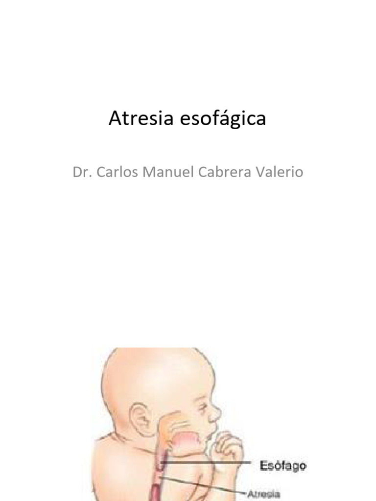 Atresia Esofagica para Preinternos | PDF | Especialidades Medicas ...