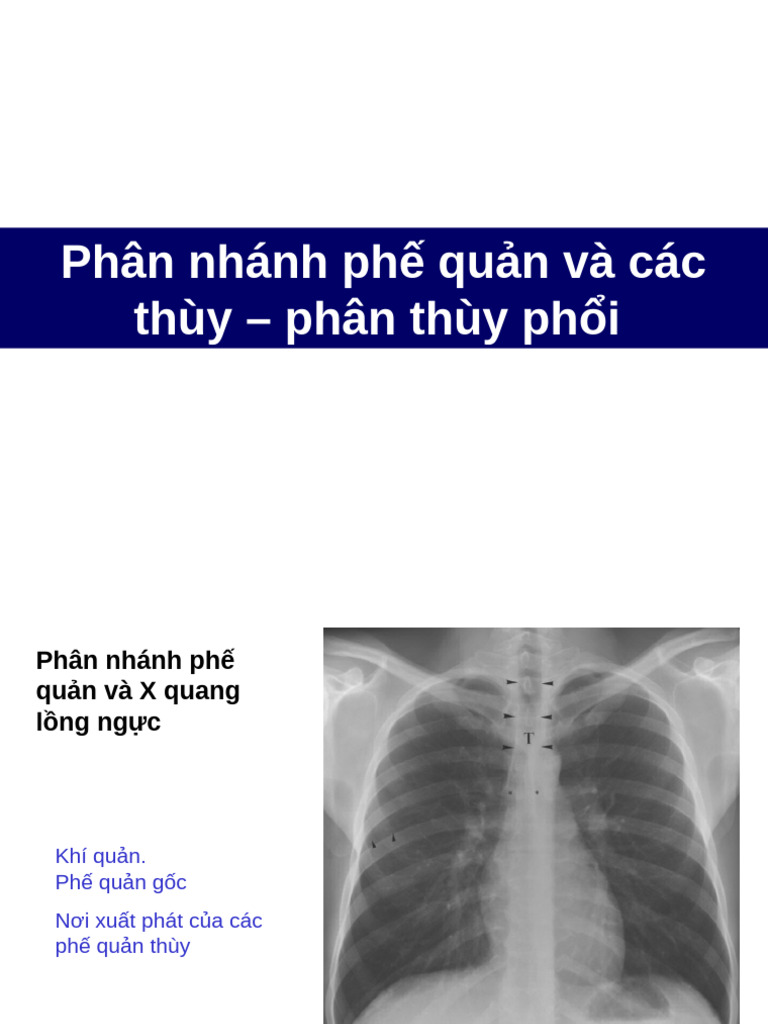 CT Giai Phau Phan Thuy Phoi | PDF
