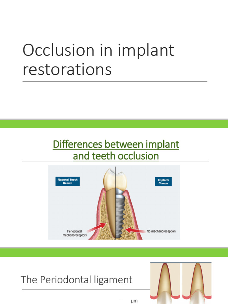 Occlusion in Implant Restorations Summary | PDF | Dental Implant ...
