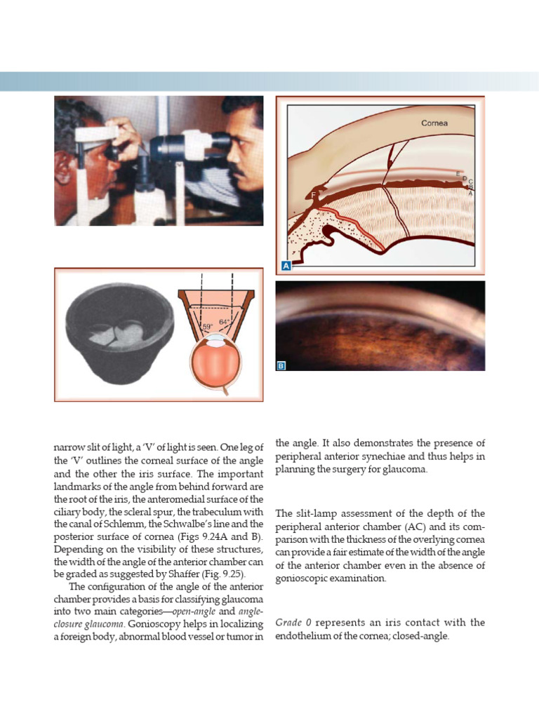 Nema - Textbook of Ophthalmology, 5th Edition-8 | PDF | Glaucoma | Cataract